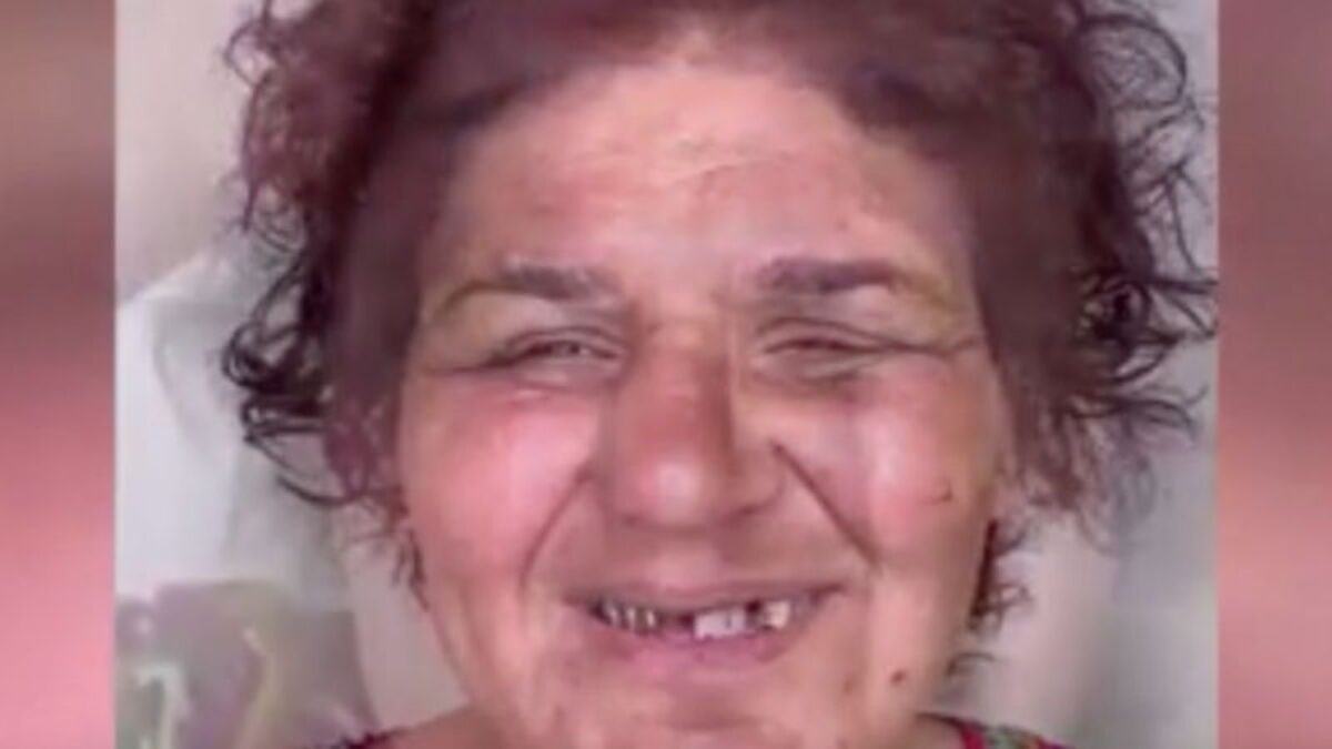 This Woman's Face Changed Drastically After She Underwent A Peculiar ...