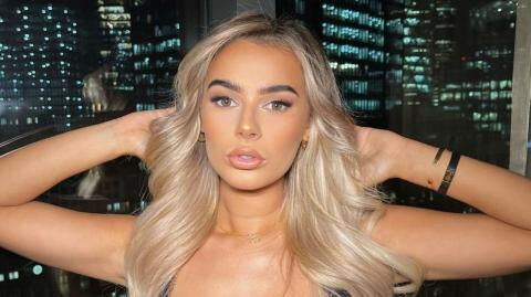 Lillie Haynes opens up about her recent nose job