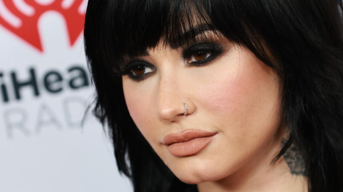 Got a chin dimple? Here’s the weird reason why