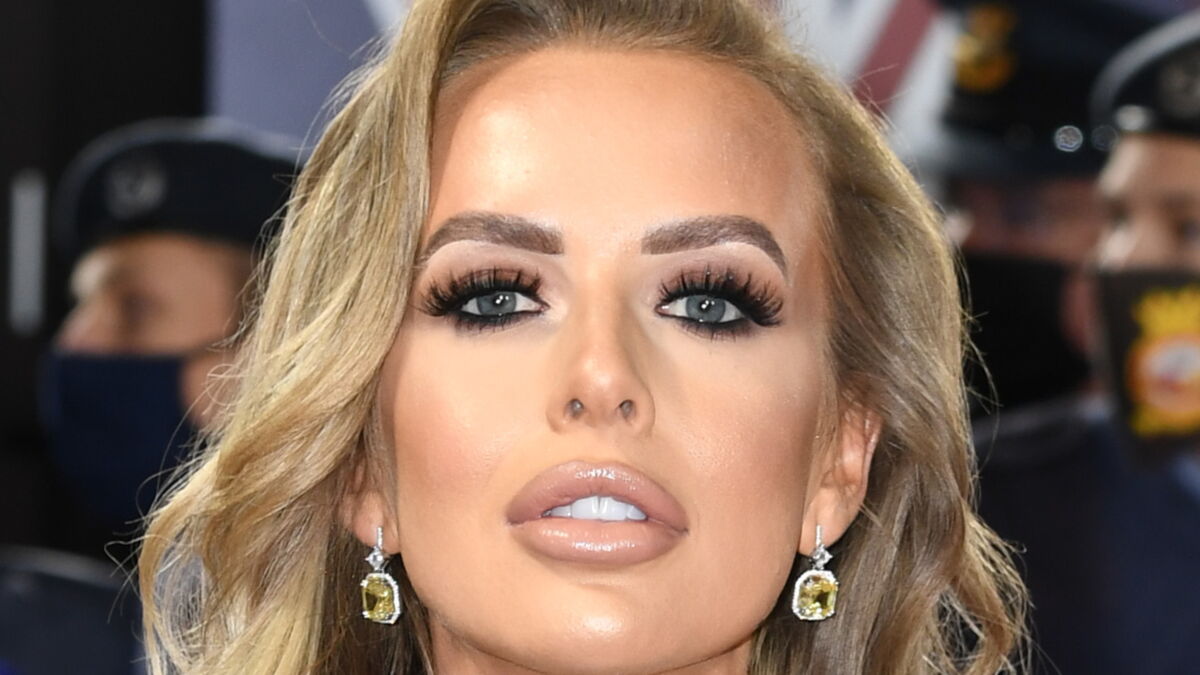 Faye Winter reveals transformation as she gets lip filler dissolved