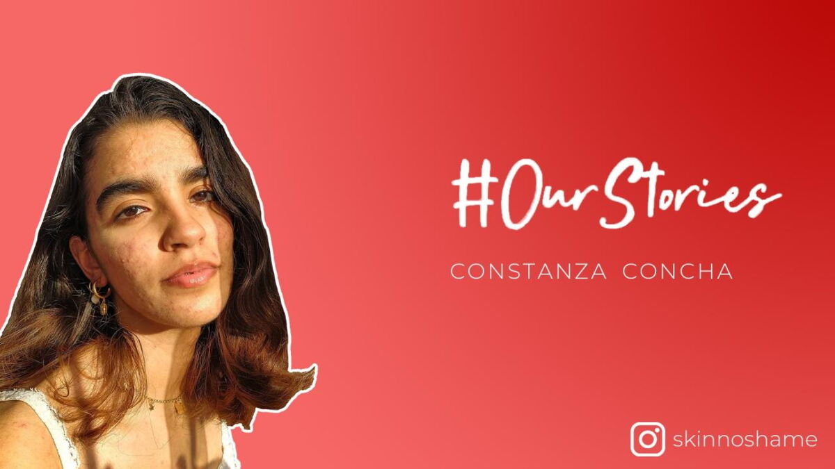 In conversation with skin positivity influencer Constanza Concha