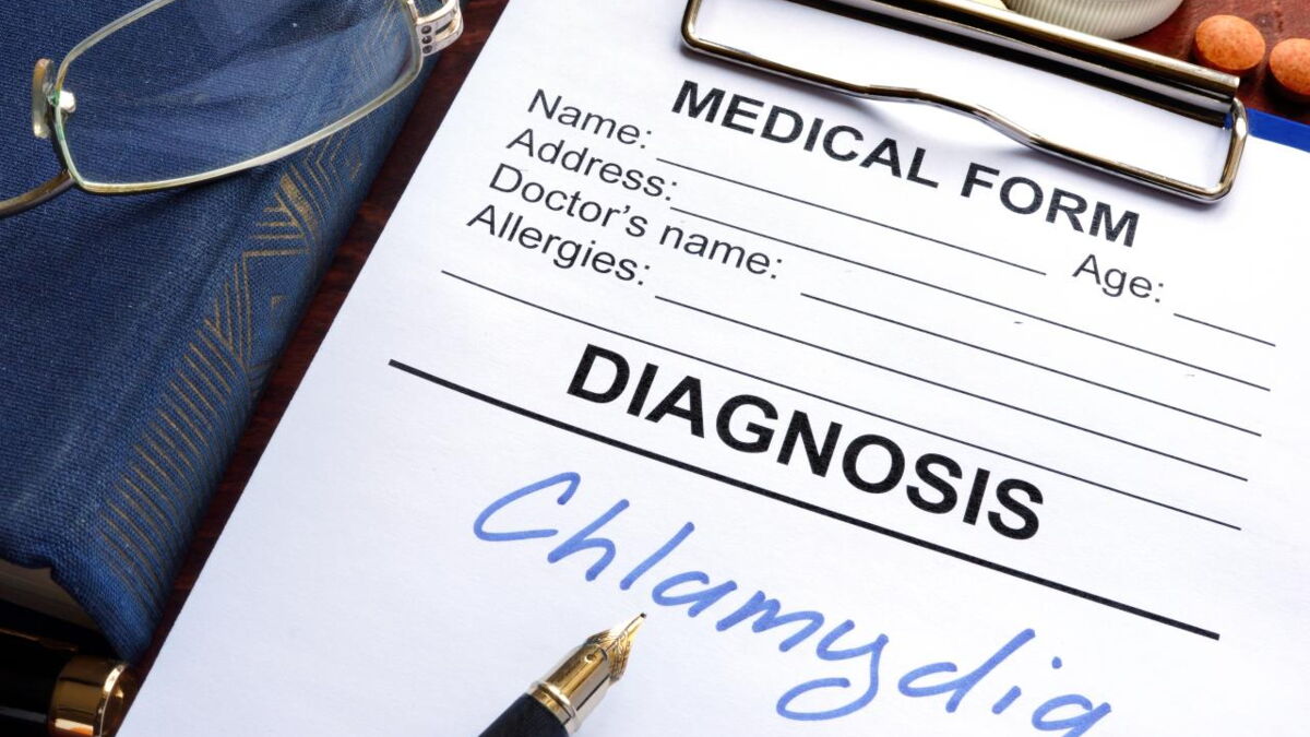 Chlamydia: This is the unusual symptom that shows up on your face