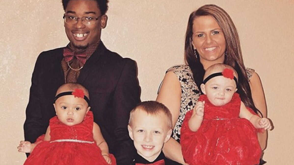 Kalani et Jarani Dean : ces deux soeurs jumelles sont nées... de ...