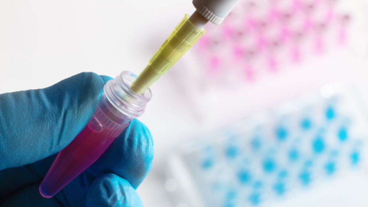 Test génétique pour éviter les cancers héréditaires : ça concerne qui