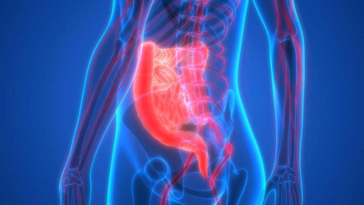 Candidose : symptômes et traitement