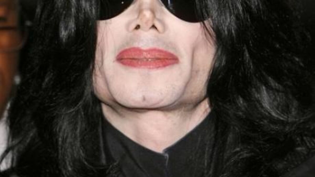 Michael Jackson, atteint d’une maladie génétique incurable?