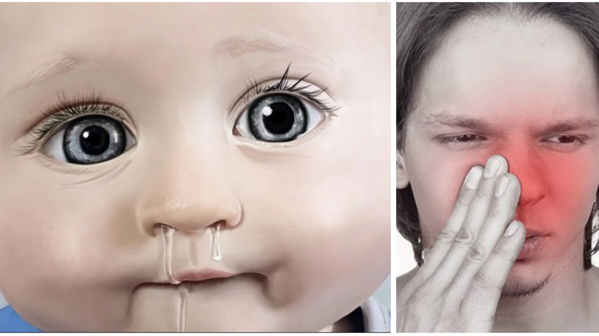 Grâce à cette astuce, vous n'aurez plus jamais le nez bouché