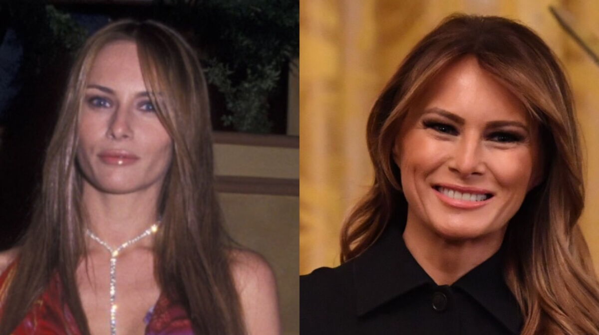 Melania Trump : découvrez l'évolution physique de l'épouse de Donald Trump