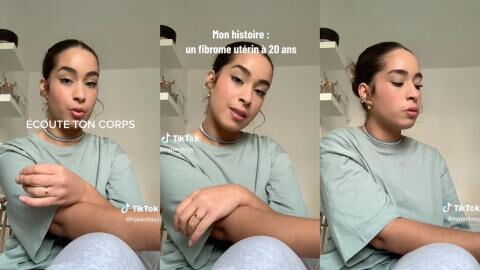 Fibrome utérin : définition, traitement et opération