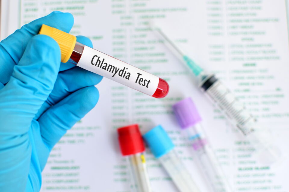 Chlamydia: This is the unusual symptom that shows up on your face