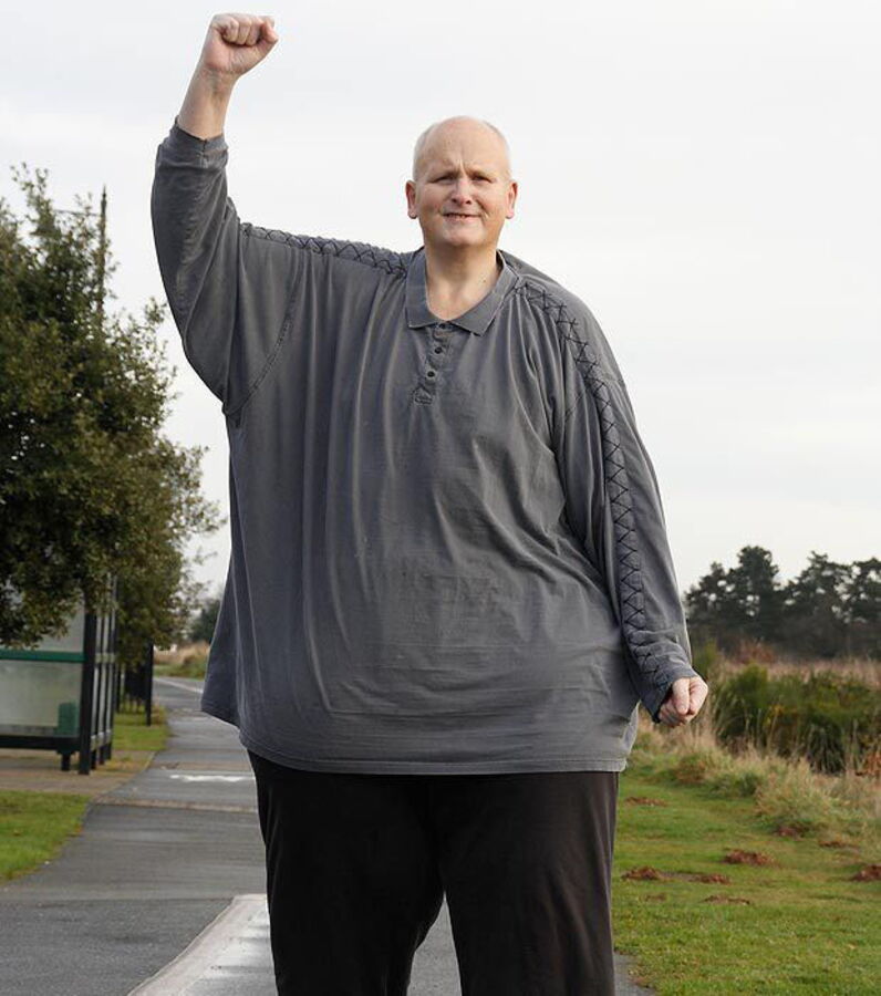 Fotos : Der dickste Mann der Welt hat fast 300 Kilo abgenommen!