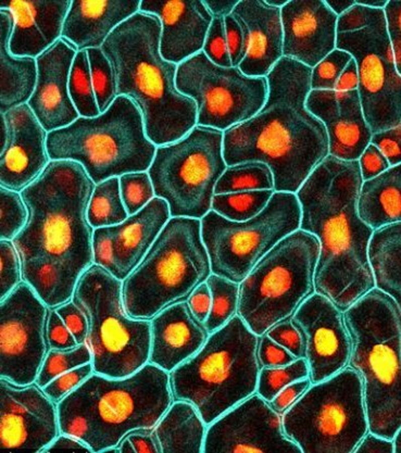 Photos : Découvrez les plus belles images de cellules végétales
