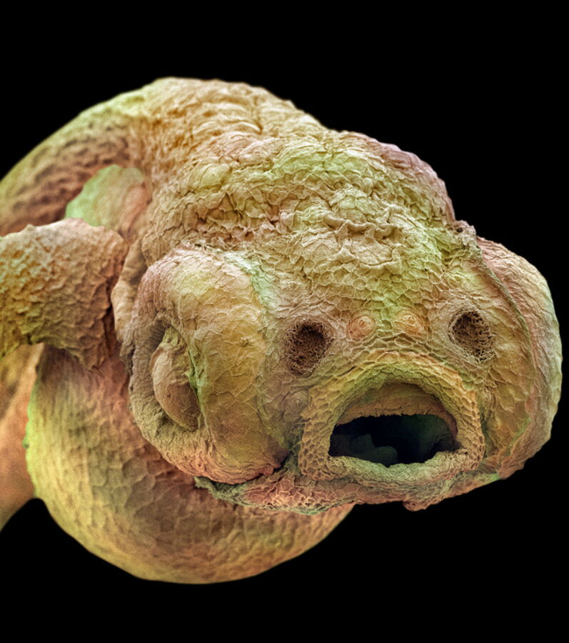 Photos : Ces 20 choses que vous auriez préféré ne jamais voir à travers ...