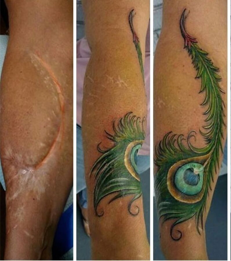 Photos : 10 Brilliant Ways To Incorporate Scars With A Tattoo Design