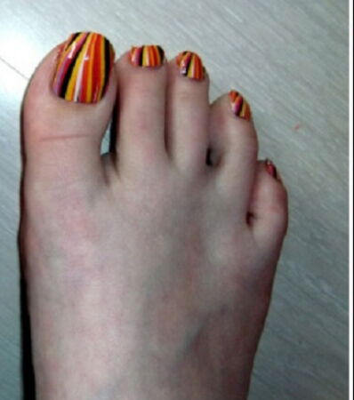 The worlds ugliest feet ranked