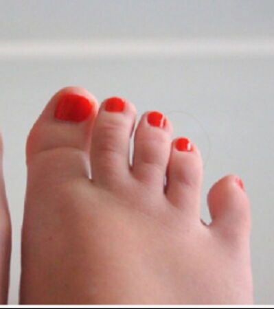 Photos : The worlds ugliest feet ranked