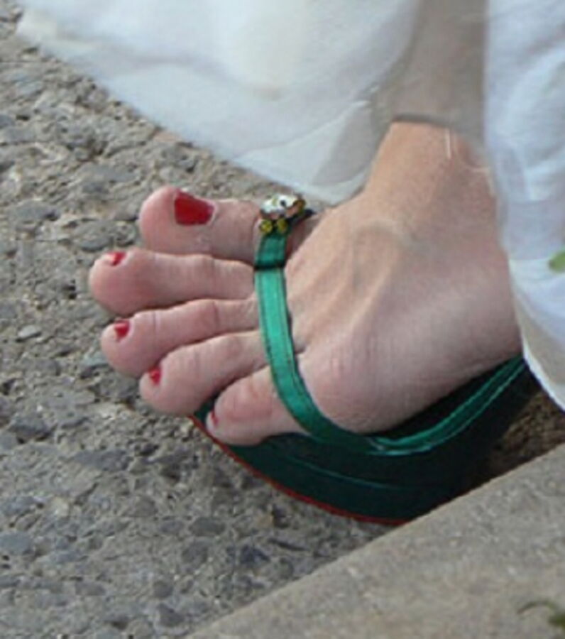 Photos : The worlds ugliest feet ranked