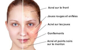 Soin de la peau - Soin de la peau : des problèmes de peau au bronzage ...